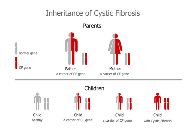 Genetics & Diagnosis – CF Physio